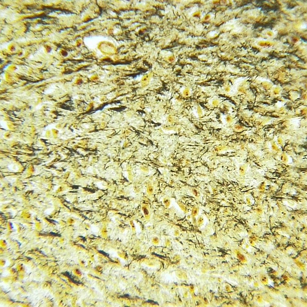 Histology Slides: Nerve Tissue Cell Structure View, High Quality ...