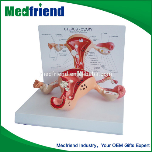 Mfm029 Wholesale Human Anatomical Uterus Model, High Quality Mfm029 ...