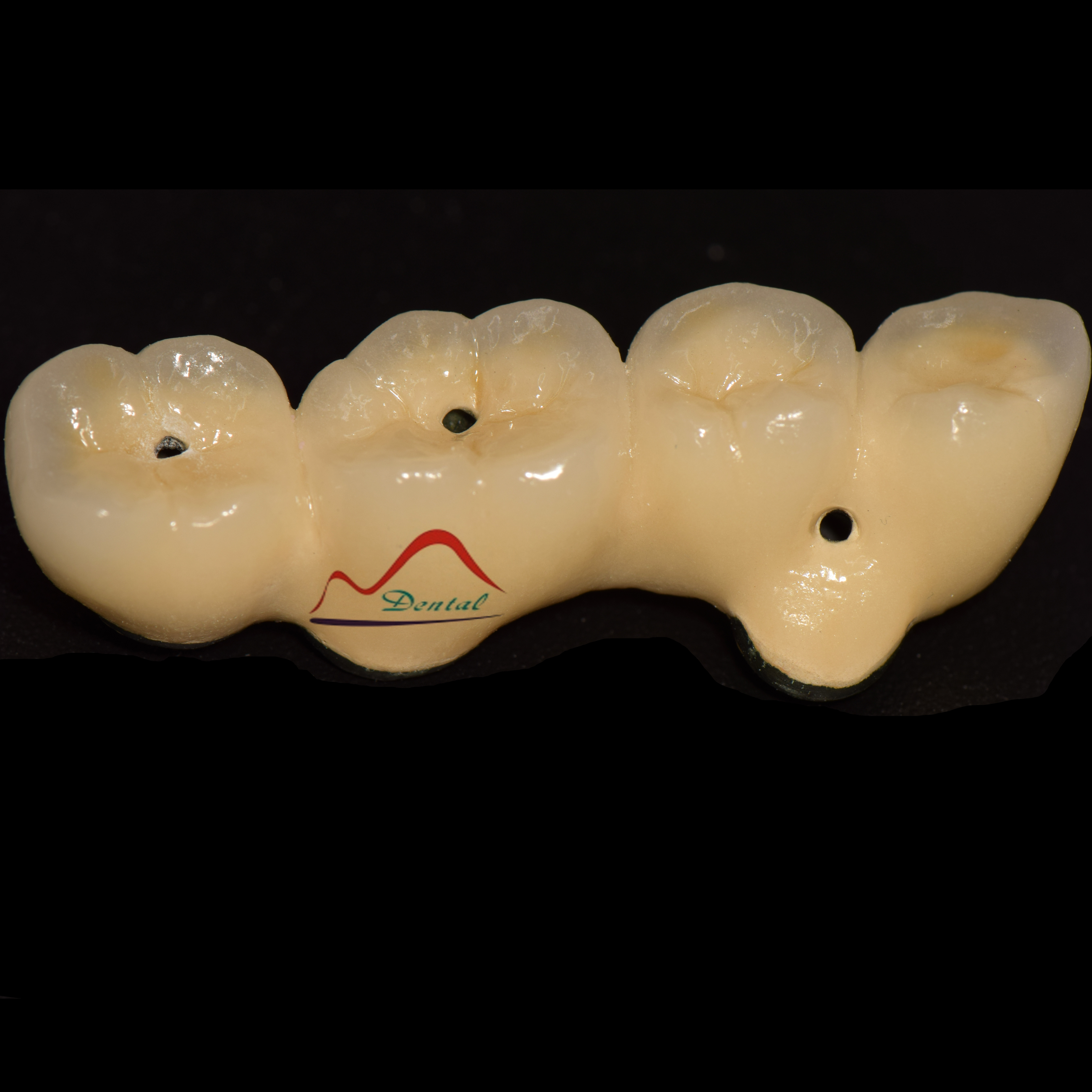 สะพานเทียมทันตกรรม Pfm คุณภาพสูง สะพานเทียมทันตกรรม Pfm บน bossgoo.com