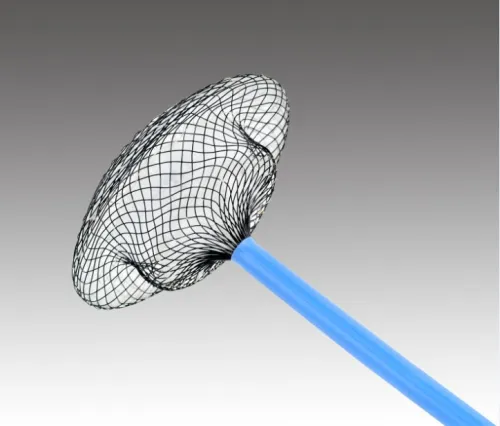 Atrial Septal Defect Closure Catheter, High Quality Atrial Septal ...