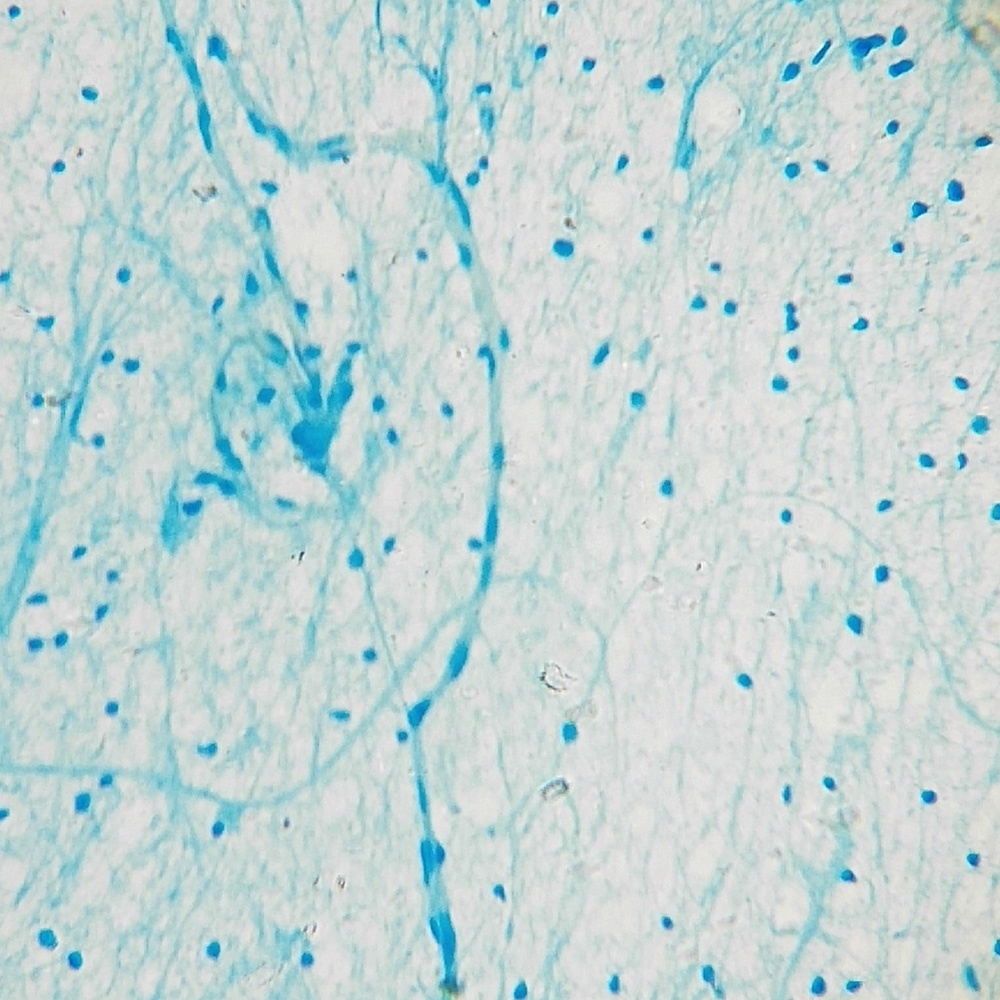 View Histology Slides: Epithelium, Muscle, Nerve, And Connective ...