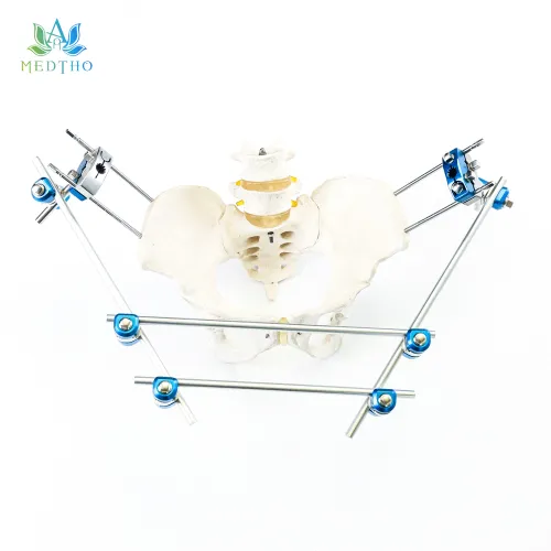 Combination Pelvic External Fixator In Orthopedic, High Quality ...