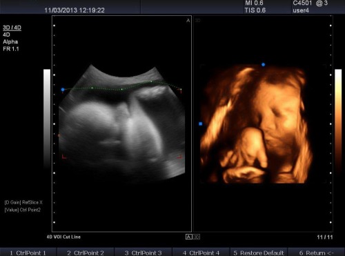 Du8-m6 Dc Trolley Doppler Ultrasound Scanner, High Quality Du8-m6 Dc ...