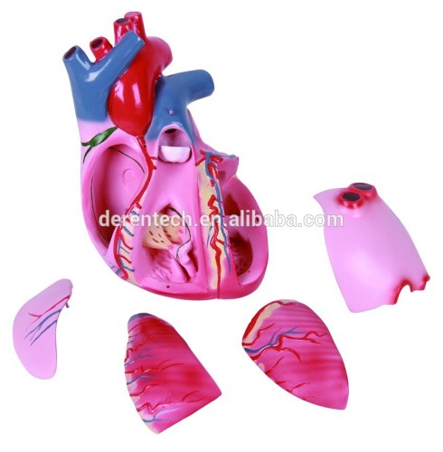 Human Heart Model, Enlarged Heart Model ,giant Heart Model, High ...