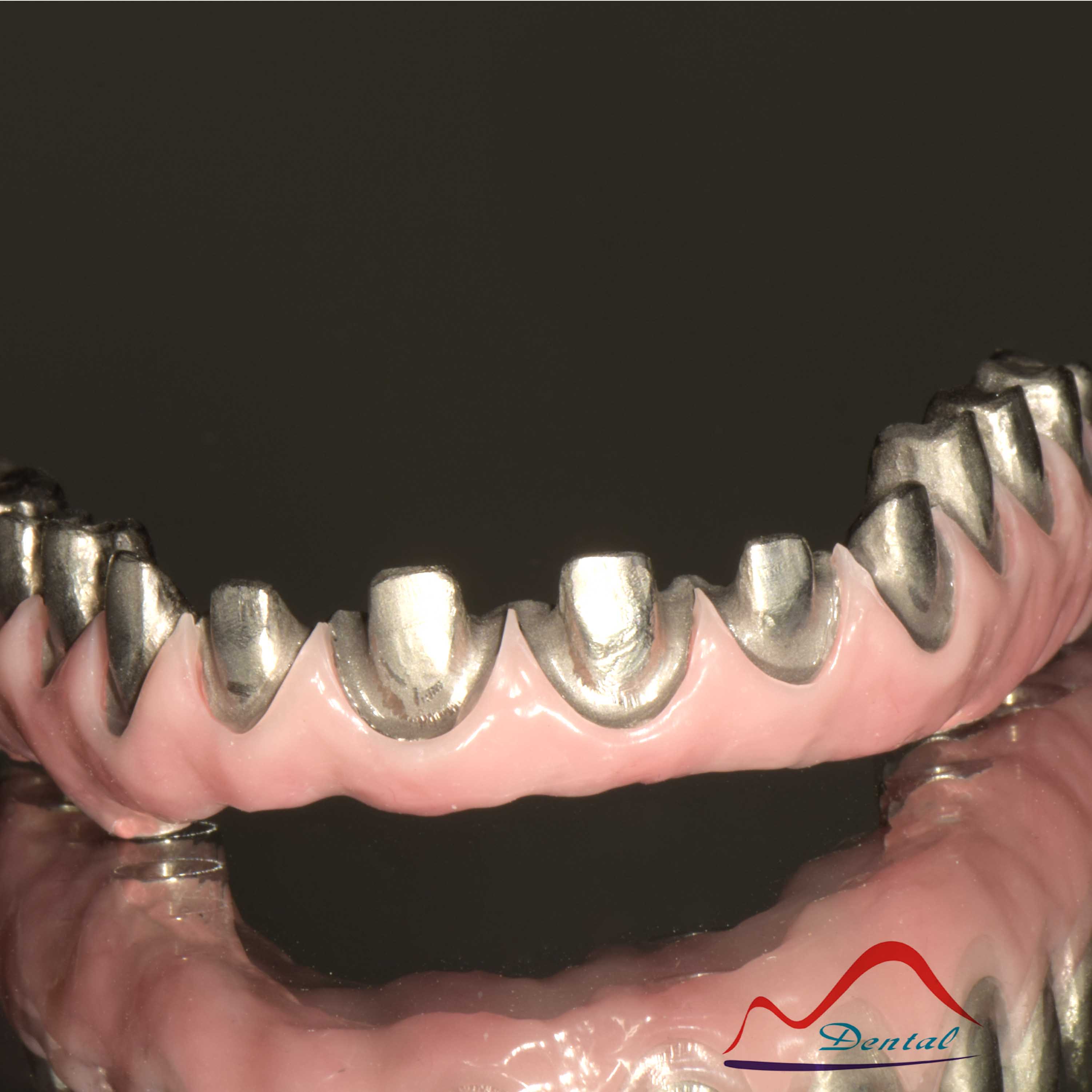 나사 식 임플랜트 말로 브릿지, Bossgoo.com의 고품질 나사 식 임플랜트 말로 브릿지