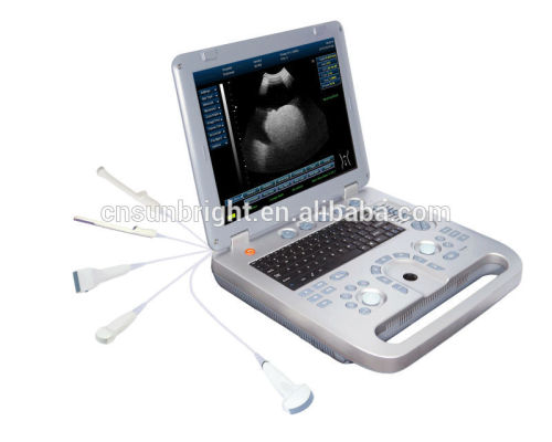 Pc- Base Cardiac Laptop-sized Ultrasound Machine, High Quality Pc- Base ...