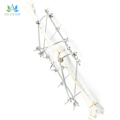 Ex Fix Knee, High Quality Ex Fix Knee on Bossgoo.com