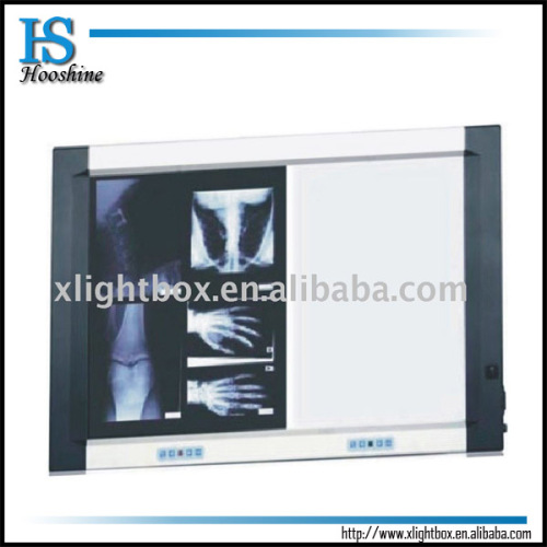 Two Sections Medical X-ray Film Observation Box/observation Lamp, High ...