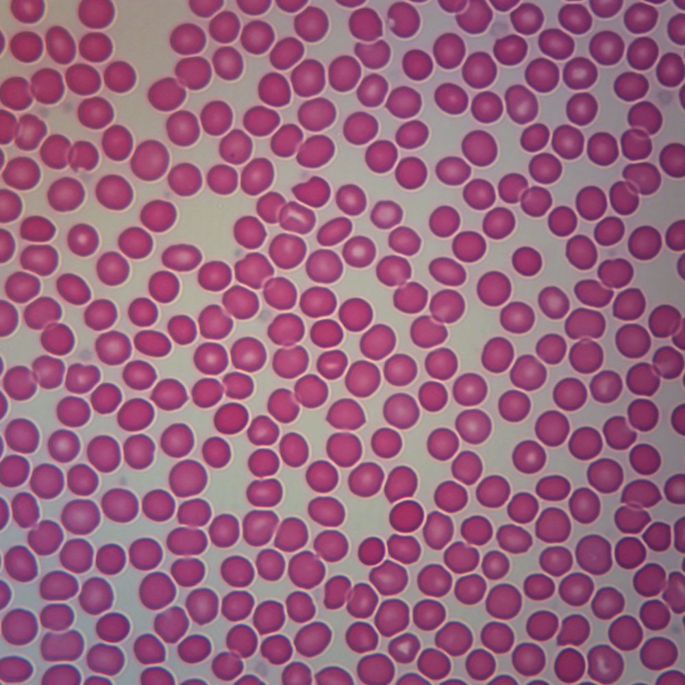 Direct Factory Hematology Blood Smear Microscope Slides, High Quality ...