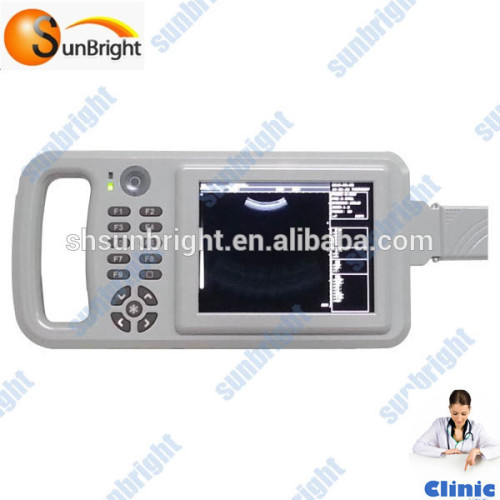 Digital Palm Smart Portable Ultrasound Machine, High Quality Digital ...