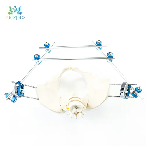 Combination Pelvic External Fixator In Orthopedic, High Quality ...
