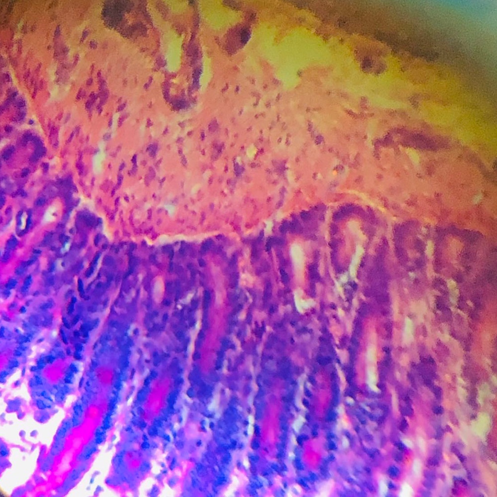View Histology Slides: Epithelium, Muscle, Nerve, And Connective ...