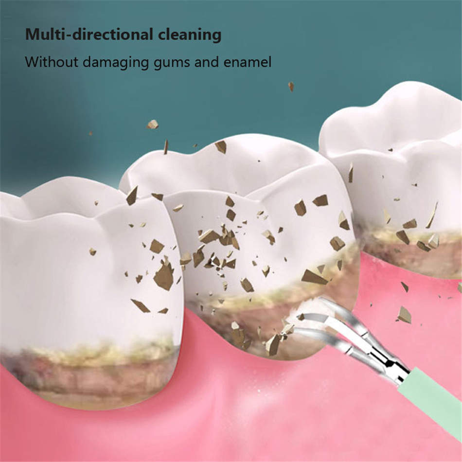 5 In 1 Electric Ultrasonic Sonic Cute Dental Scaler Tooth Calculus ...