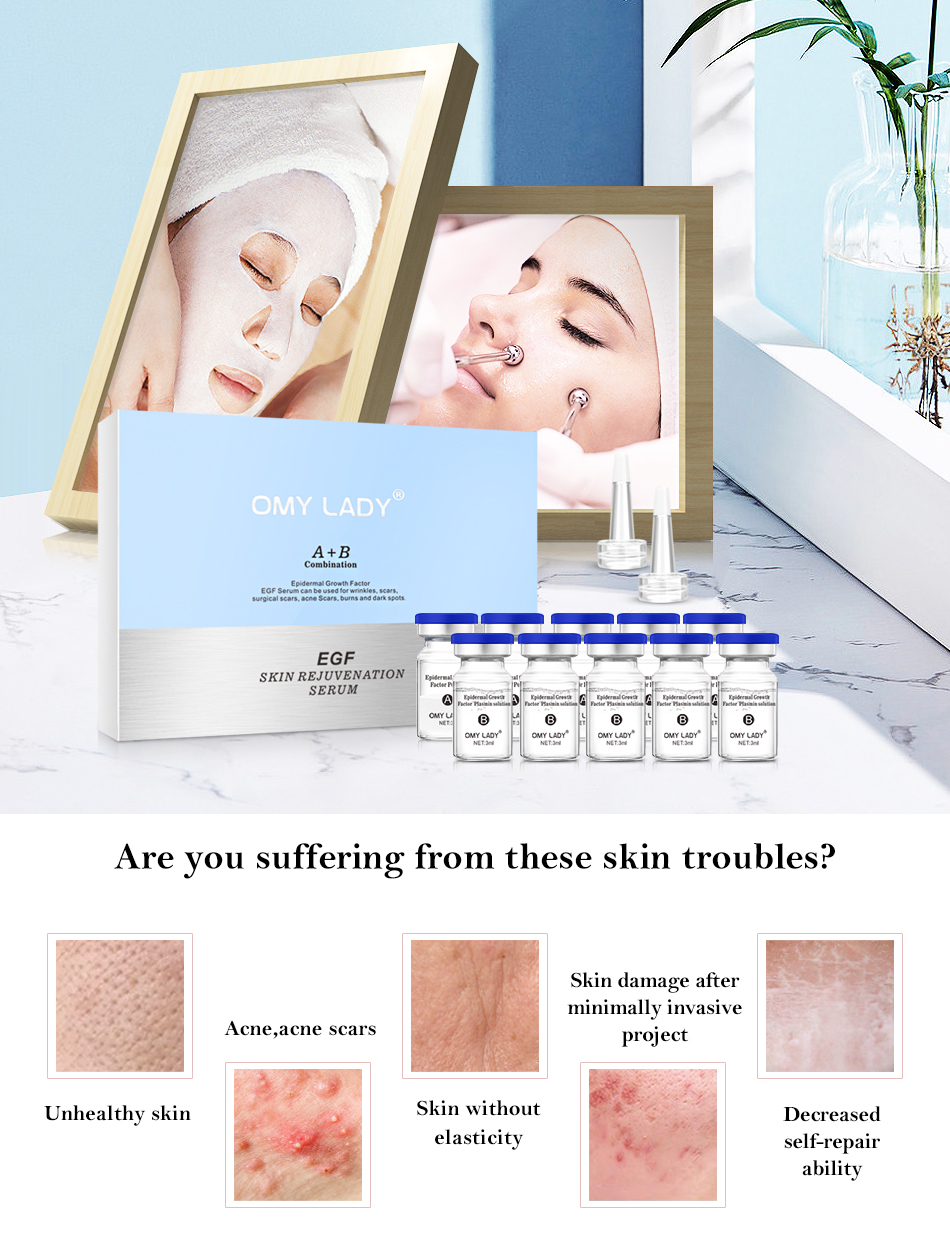After Sun Skin Repair Spa: Anti-aging Facial Care With Egf Lyophilized ...
