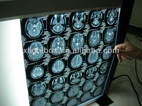 Single Bank X-ray Film Viewer/self-induction/led/backlit, High Quality ...