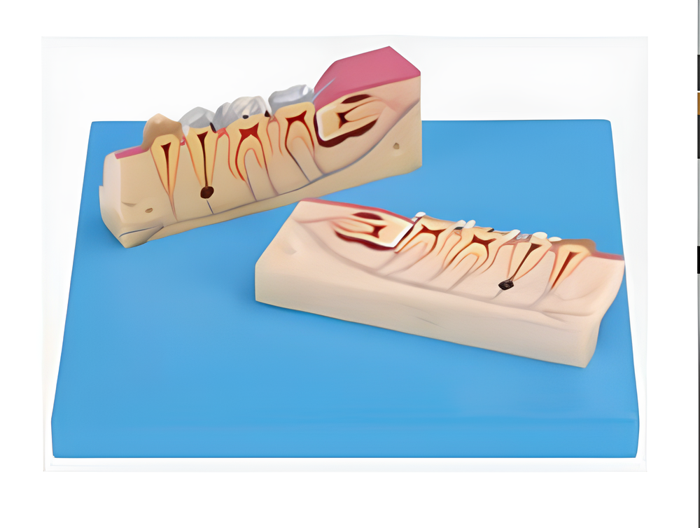 Dissected Model Of Teeth Tissue, High Quality Dissected Model Of Teeth ...