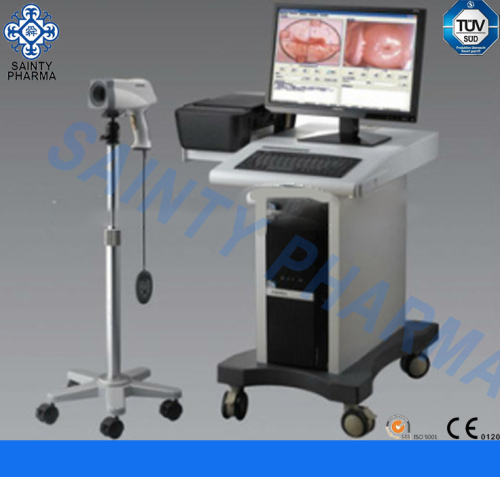 Medical Colposcope Digital Imaging System (sp220), High Quality Medical ...