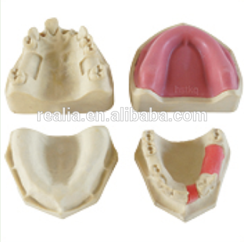 Implant Practice Teeth Model, High Quality Implant Practice Teeth Model ...