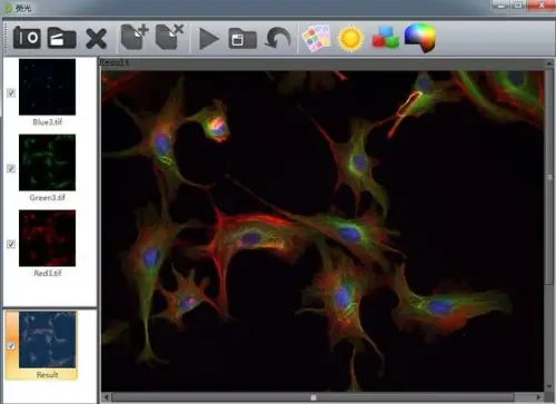 Vimage Lite/ Pro, Microscopy Imaging Software, Metallurgical Analysis ...