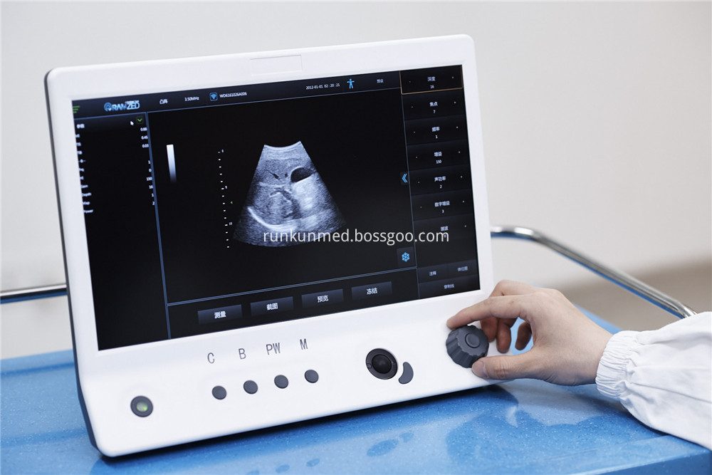 Wireless Doppler Doppler สีไร้สาย คุณภาพสูง Wireless Doppler Doppler สี ...