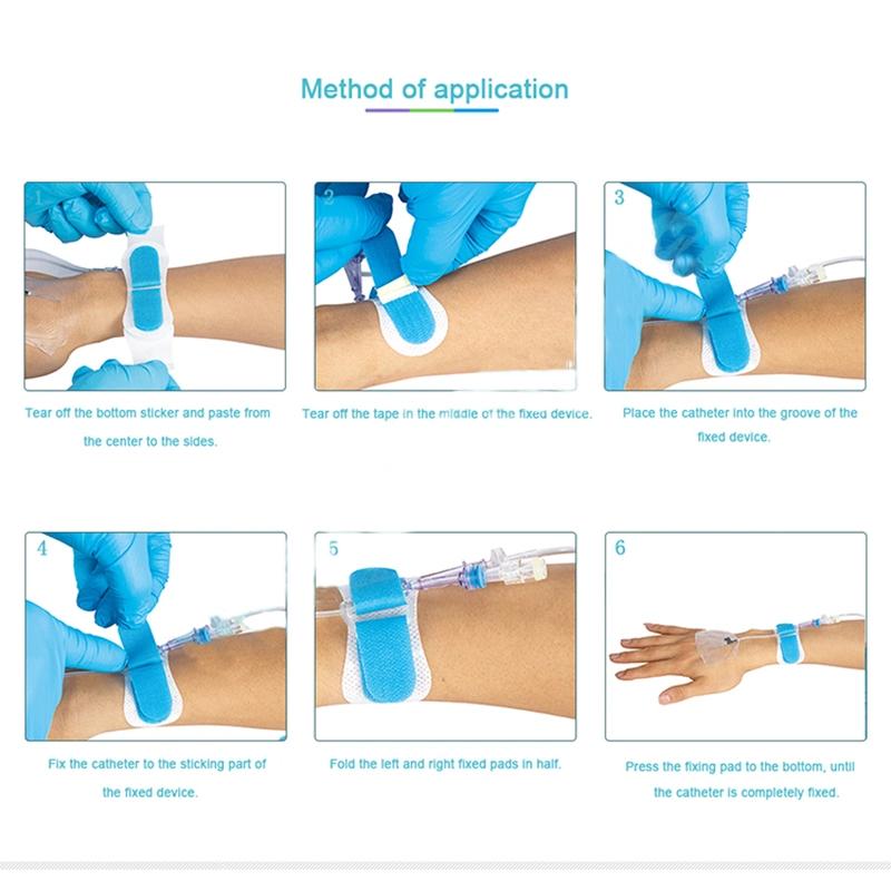 Medical Catheter Fixation Devices: Cvc/picc Securement Kits And Fistula ...