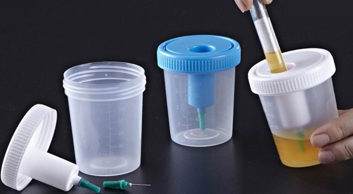Laboratory Hospital Vacuum Urine Container, High Quality Laboratory ...