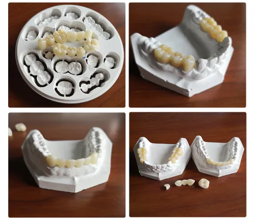 Special Dental Zirconia Milling Machine, High Quality Special Dental ...