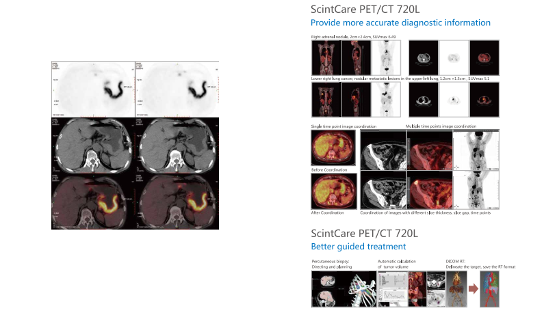 Tomography Pet Ct Scanner, High Quality Tomography Pet Ct Scanner on ...
