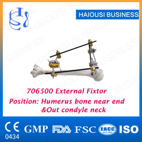 Hot Sale External Fixator Surgical Hoffman, High Quality Hot Sale ...
