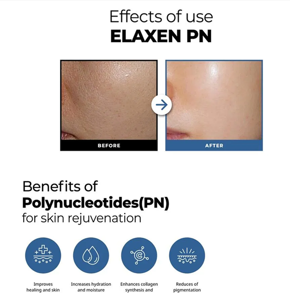 연어 Dna Elaxen Pn 피부 부스터 주입, Bossgoo.com의 고품질 연어 Dna Elaxen Pn 피부 부스터 주입 연어 Dna Elaxen Pn 피부 부스터 주입, Bossgoo.com의 고품질 연어 Dna Elaxen Pn 피부 부스터 주입