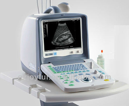 High Performance Medical Digital Ultrasound Scanner Ultrasonic Machine ...