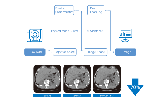 Tomography Pet Ct Scanner, High Quality Tomography Pet Ct Scanner on ...