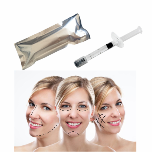 Hyaluronic Acid Dermal Filler Injection Buttock 1cc, Bossgoo.com의 고품질 Hyaluronic Acid Dermal ...