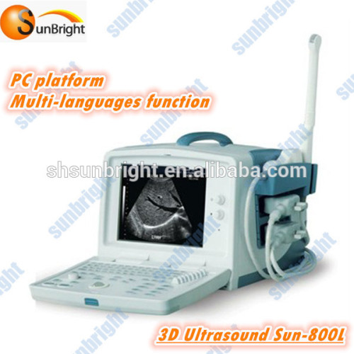 Digital Portable Ultrasound Machine / Ultrasound Scanner/ Portable ...