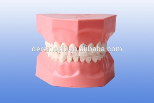 Standard Dental Model , Orthodontic Model, High Quality Standard Dental ...