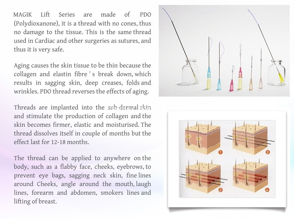 피부 회춘과 리프팅을위한 Pdo 스레드, Bossgoo.com의 고품질 피부 회춘과 리프팅을위한 Pdo 스레드