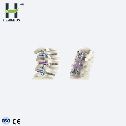 Orthopaedic Spine Series Titanium Plate Implants, High Quality ...