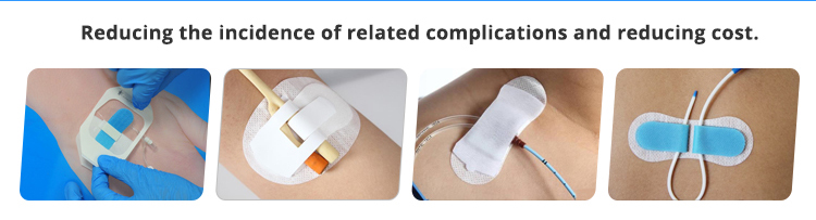 Qichuang Dialysis Cvc/picc Securement Device And Medical Dressing Kit ...