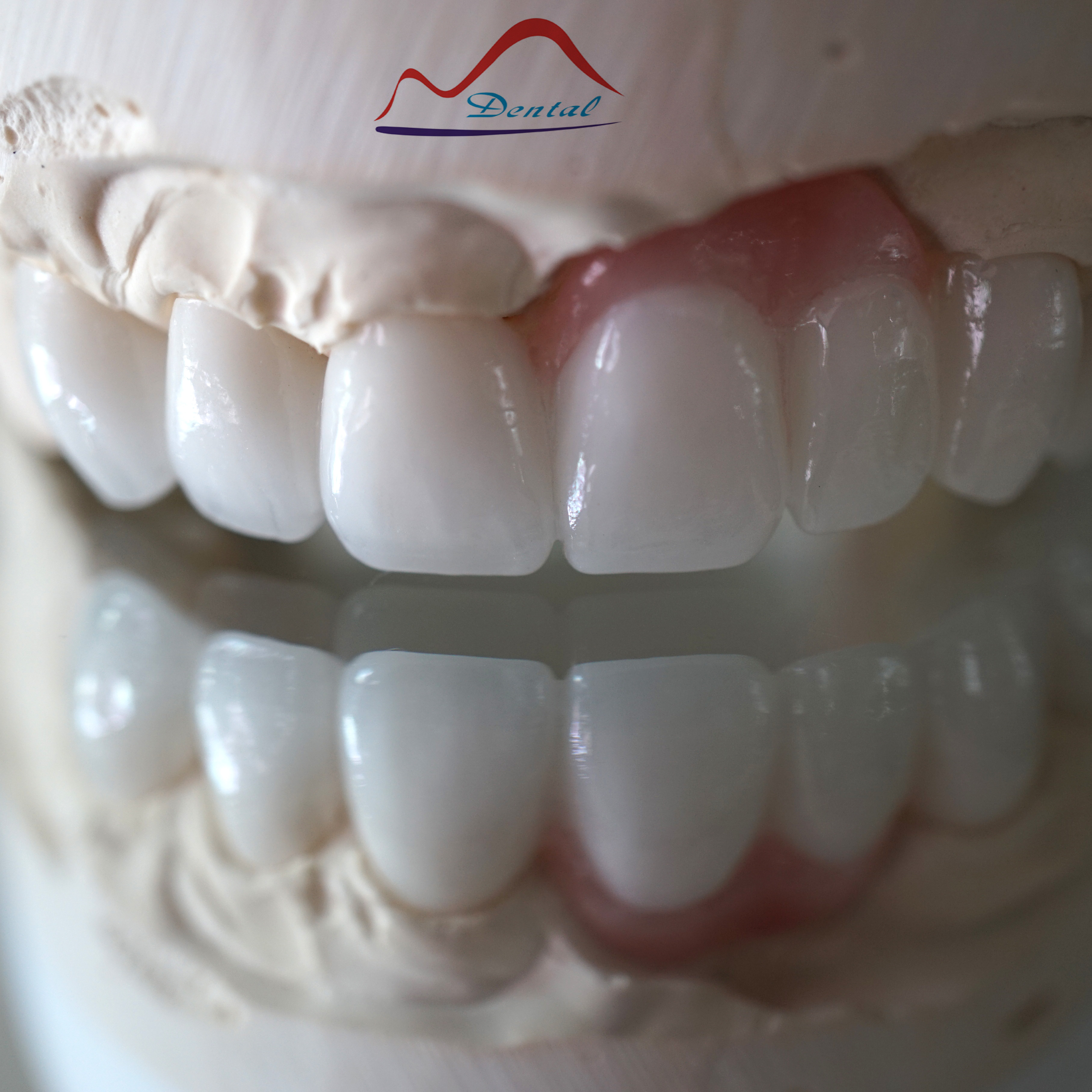3shape Zirconia Bridge With Gum Porcelain, High Quality 3shape Zirconia ...
