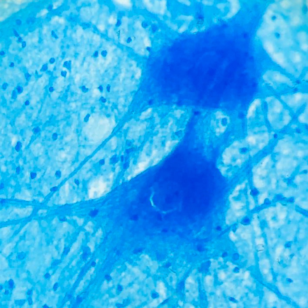 View Histology Slides: Epithelium, Muscle, Nerve, And Connective ...