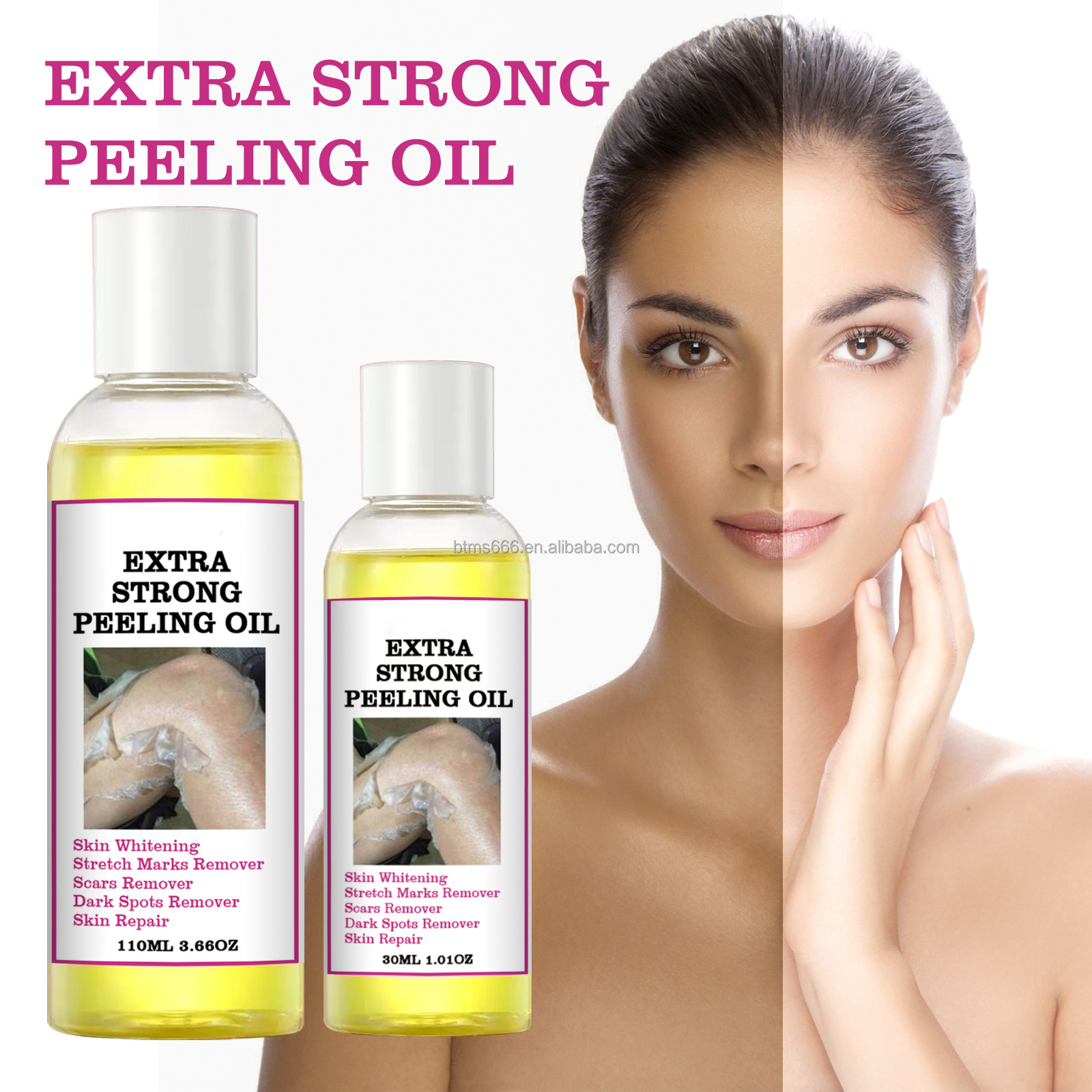 Extra Strength Anti Dark Spots Oil For Skin Whitening And Exfoliation ...