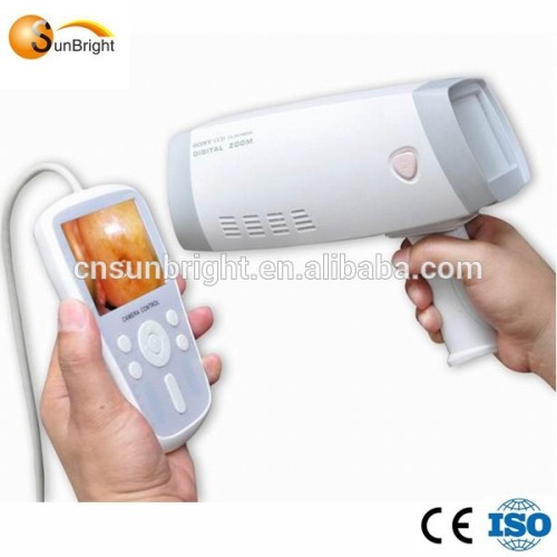 Handheld Colposcope (sun-200y), High Quality Handheld Colposcope (sun ...